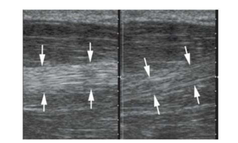 ARRT Flashcards Quizlet