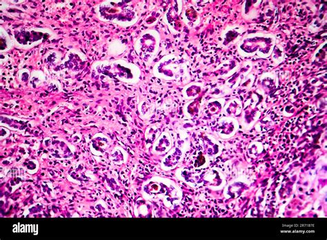 Microscope Used In Histopathology At Oscar Corey Blog