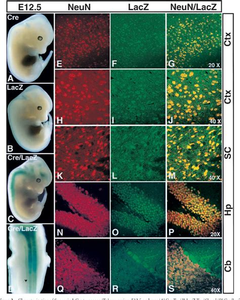 Figure 2 From Ablation Of Nf1 Function In Neurons Induces Abnormal Development Of Cerebral