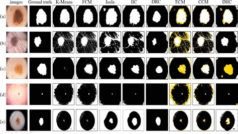 Figure 4 From Deep Hyperspherical Clustering For Skin Lesion Medical