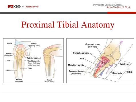 Ppt Intraosseous Vascular Access Powerpoint Presentation Free