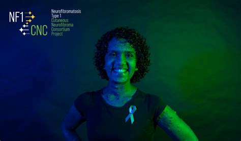 Cutaneous Neurofibromas