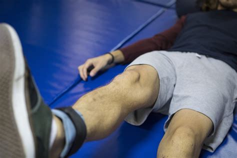 Non Surgical Management Of ACL Tears Physio Network