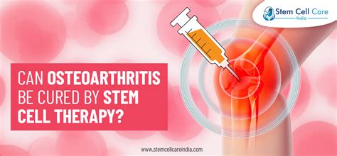 Can Osteoarthritis Be Treated By Stem Cell Therapy