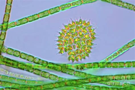 Filamentous Algae Microscope