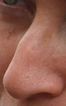 Human Nose Wikipedia