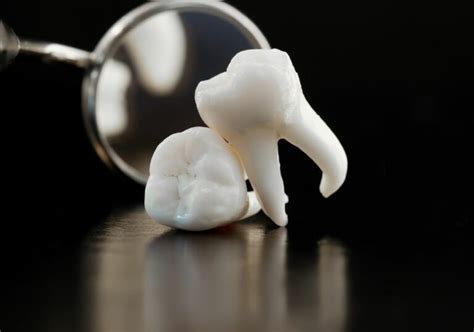Can Impacted Wisdom Teeth Shift Other Teeth Potential Risks