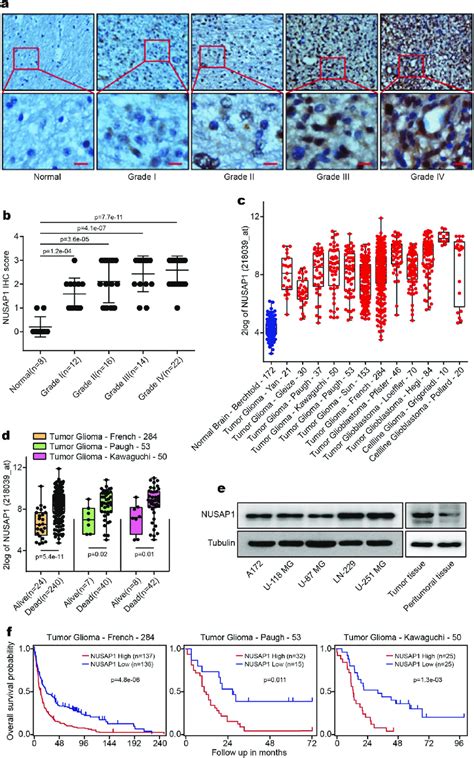 Nusap1 Is Highly Expressed In Gbm Patients And In Gbm Cells A