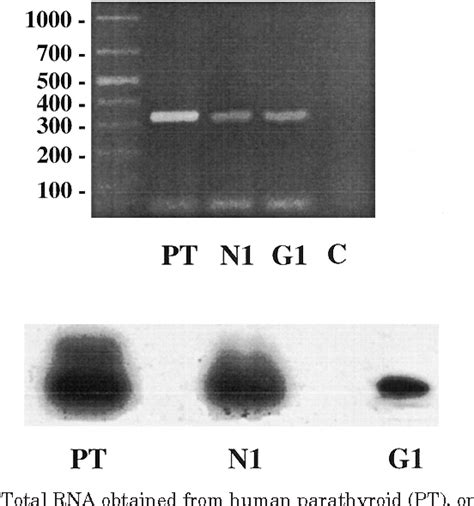 Figure 1 From Expression Of Calcium Sensing Receptor And
