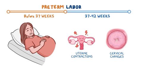 Video Preterm Labor Nursing Osmosis