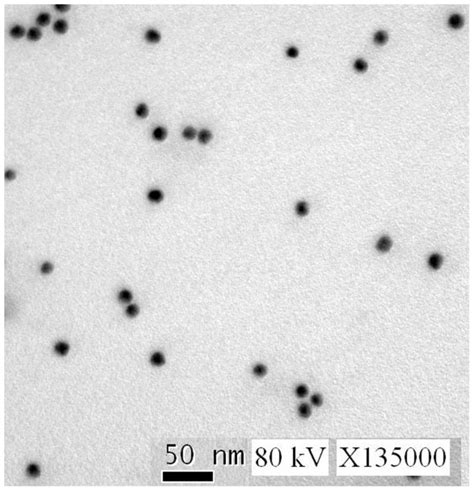 Preparation Of Colloidal Gold Immunochromatographic Strip For Detection Of Paragonimiasis