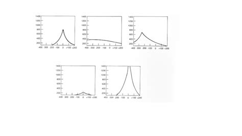 Audiology Tympanometry Types Diagram Quizlet