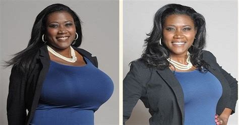 How To Reduce Breast Size Naturally Without Surgery