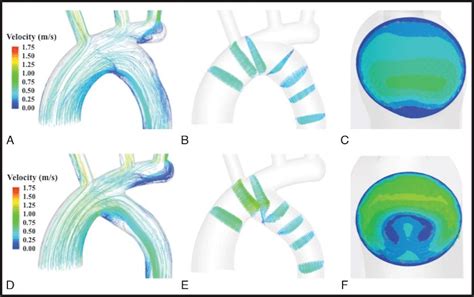 computational fluid dynamic model velocities a c represent the