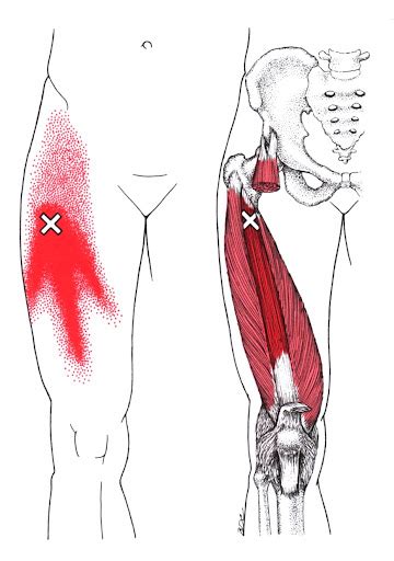 중간광근vastus Intermedius 중간넓은근에 대한 모든 것 네이버 포스트