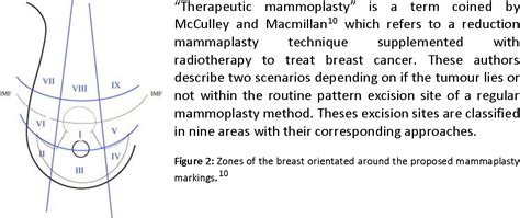 Types Of Surgical Incision Medizzy