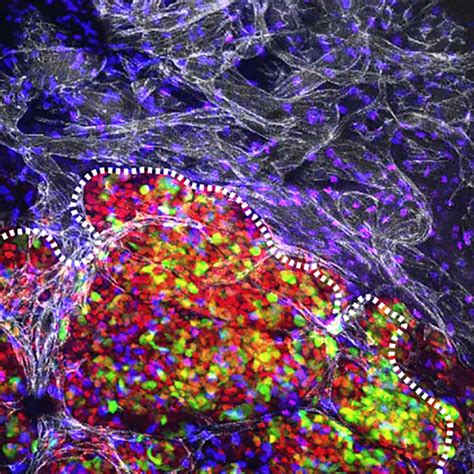 A Master Switch Controls Aggressive Breast Cancer Salk Institute For