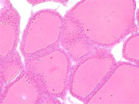 Mammal Thyroid Gland Section