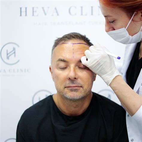 Neograft Hair Transplant In Turkey Procedure And Cost Heva Clinic