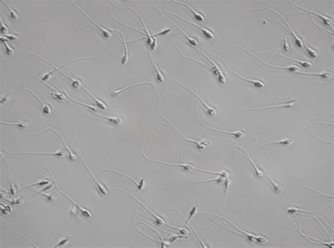 Abnormal Sperm Morphology Naturehill