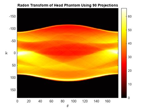The Inverse Radon Transformation Matlab And Simulink