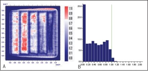 A Comparison Of X Wedges Planned And Measured Dose Distribution Using Download Scientific
