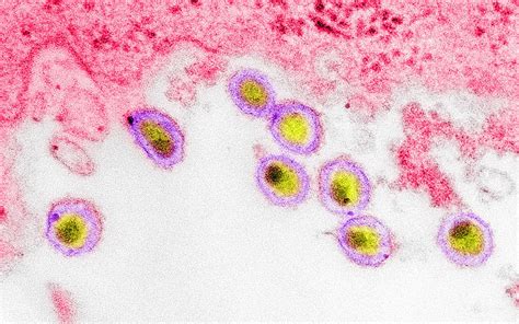 HIV And AIDS News Features And Articles Live Science