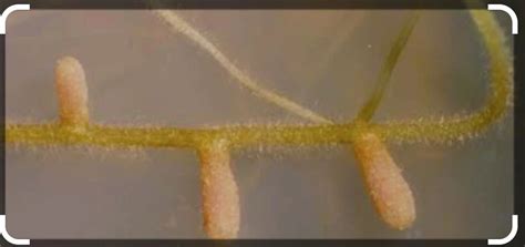 Rhizobium Meliloti Is A Species Of Bacteria That Forms Symbiotic Dr
