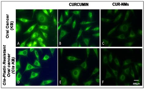 Jfb Free Full Text Curcumin Encapsulated Nanomicelles Improve Cellular Uptake And