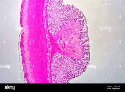 Human Vermiform Appendix Cross Section Showing Left To Right Serous