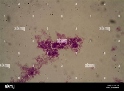 Streptococcus Bacteria Under Microscope At Joseph Cornwall Blog
