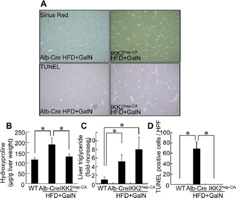 Ikk2 Hep Ca Mice Show Reduced Liver Fibrosis And Hepatocyte Apoptosis