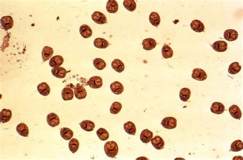 Free Picture Echinococcus Scoleces Cystic Parasitic Cestodes