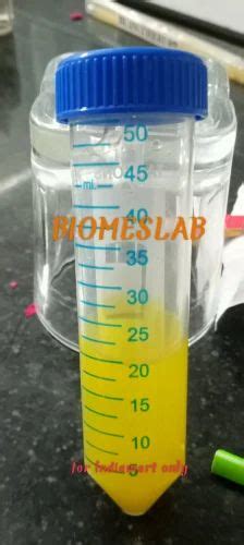 Clinical Biochemistry Service At Best Price In Vadodara By Biomes Lab
