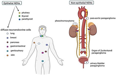 Ijms Free Full Text The Complex Histopathological And Immunohistochemical Spectrum Of