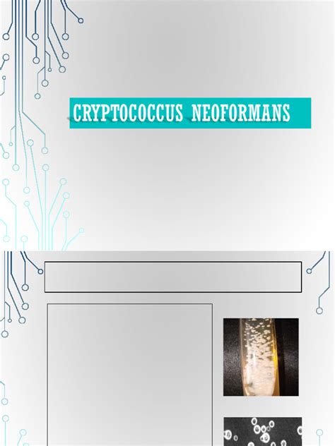 Cryptococcal Meningitis Pdf