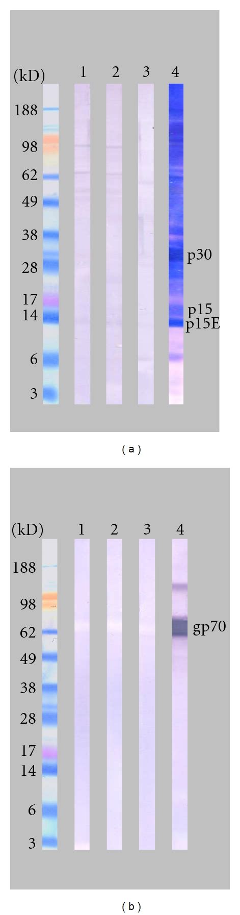 Wb Analysis Of Gp70 Cmia Reactive Samples With A Native Xmrv Viral