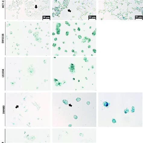 Regorafenib Effect On Cell Secretome Of The Hct 116 Cell Line Soluble