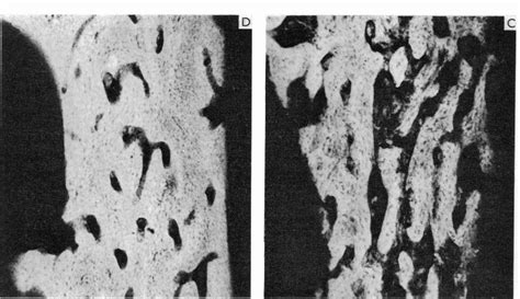 Figure 3 From The Development And Structure Of The Chimpanzee Mandible