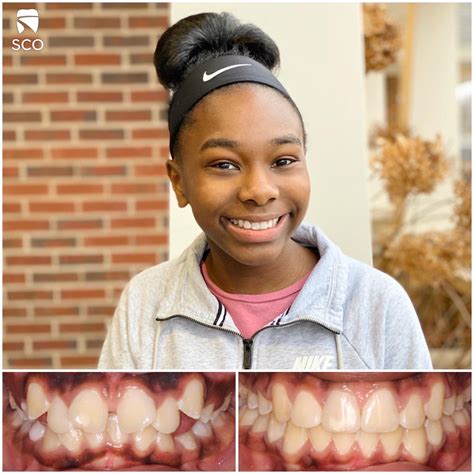 Memphis Braces Invisalign Saddle Creek Orthodontics Dr Fagala