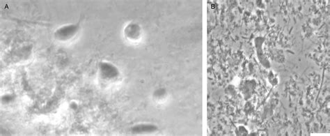A Numerous Flagellated Motile Protozoa Phase Contrast Optical Download Scientific Diagram