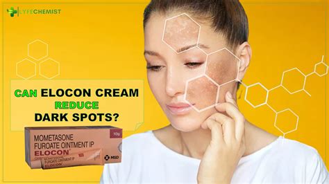Can Elocon Cream Reduce Dark Spots