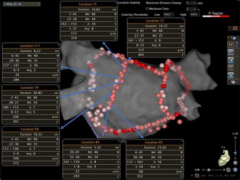 Jacc Clinical Electrophysiology Vol 9 No 8 Part 2