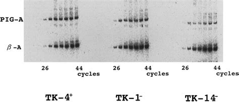 Quantitative abnormalities of PIG A transcripts in TK 1 Ï and TK 14 Ï