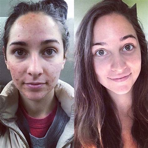 Ashleys Plexus Page Added A New Photo Ashleys Plexus Page