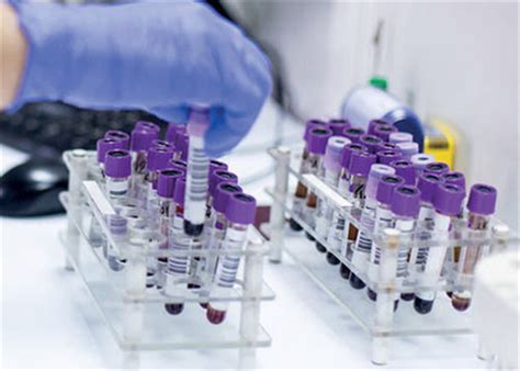 Reporting Lims Tdnexlabs Technidata Analysis Management
