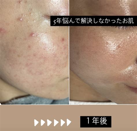お肌が変わると、人生が変わる。 会員専用com