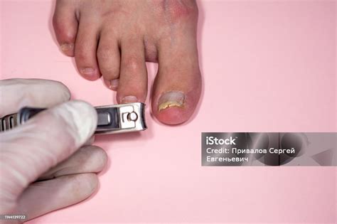 분홍색 배경에 고립 된 손 발톱 장갑에 있는 닥터의 손은 못에 손상을 검사 합니다 손톱 판에 기계적 손상 쉘 락 또는 젤 바니시