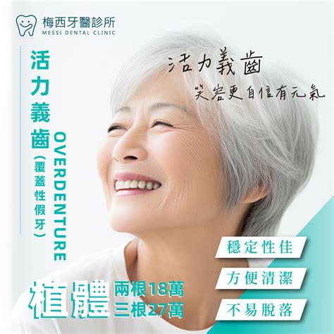 梅西牙醫診所 大面積缺牙，重建療程還有這一種！ 活力義齒🦷覆蓋性活動假牙 植體兩根18萬／三根27萬 不易脫落 易於清潔 價格親民