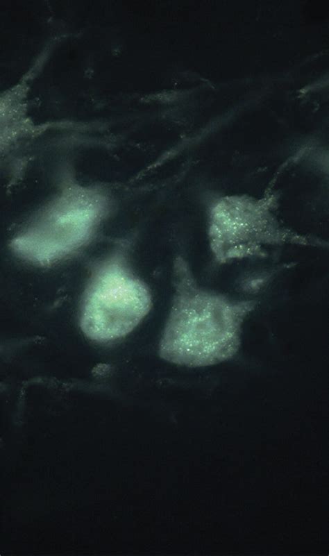 Cleaved SNAP 25 Staining Of A Spinal Cord Section One Week After Injury